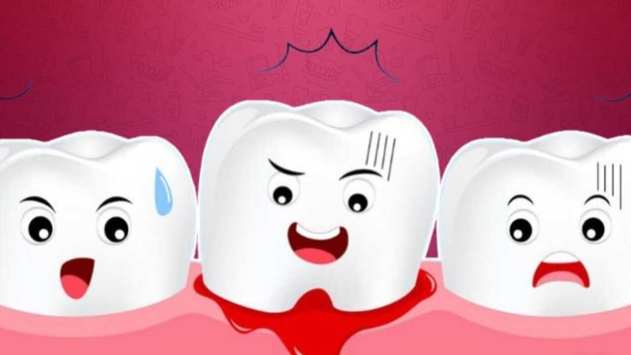 Sakit Gigi vs Sakit Gusi, Mana yang Sedang Anda Alami?